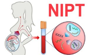 Chi Phí Xét Nghiệm NIPT và Những Điều Cần Biết
